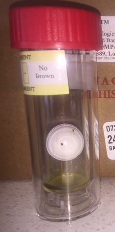 What would cause the media at the bottom of the BART™ Test for Iron ...